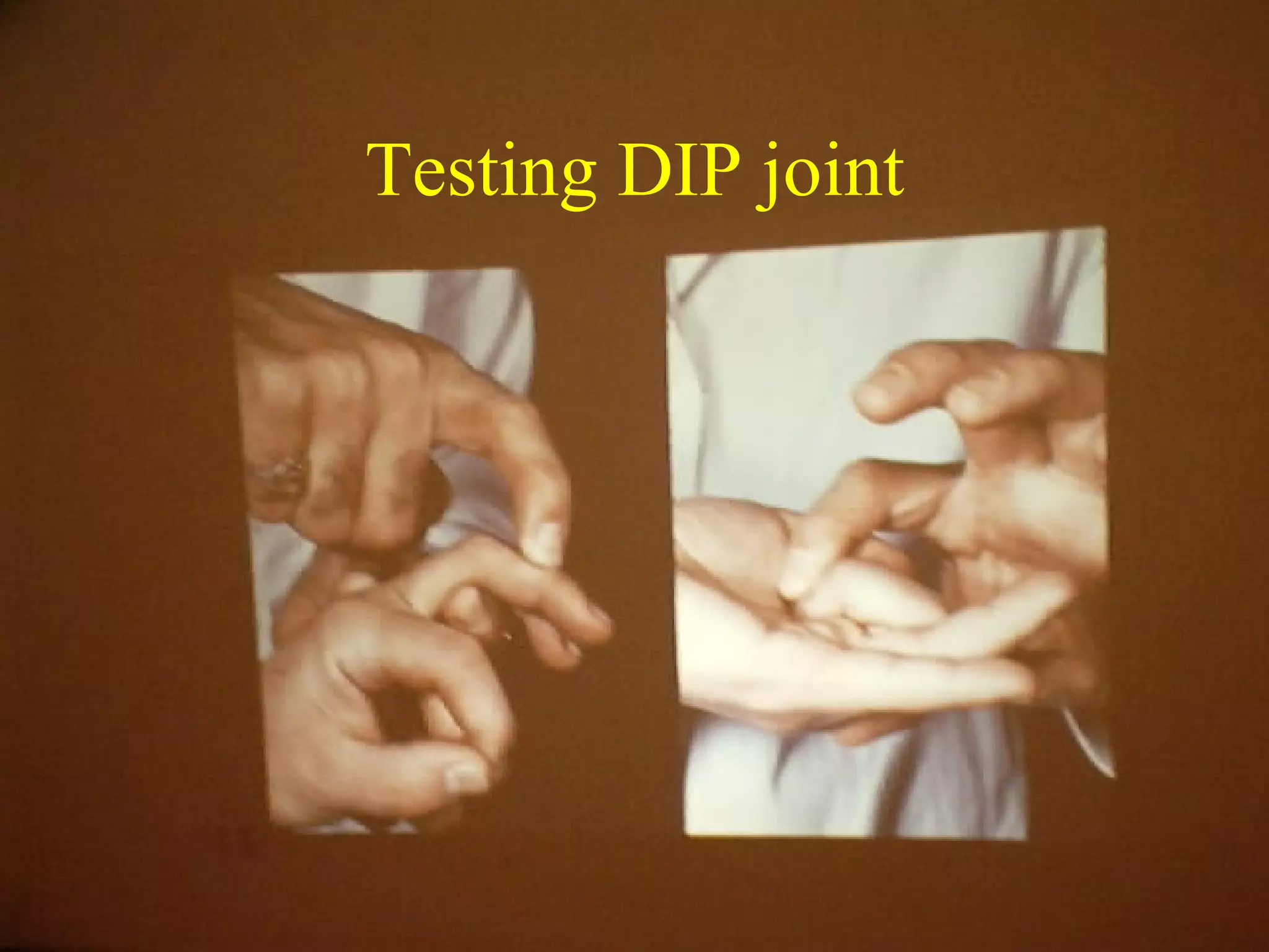 Examination Of The Hand & Wrist | PPT