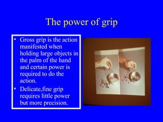 Examination Of The Hand & Wrist | PPT