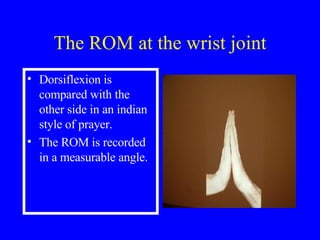 Examination Of The Hand & Wrist | PPT