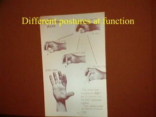 Examination Of The Hand & Wrist | PPT