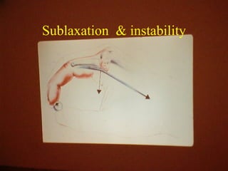 Examination Of The Hand & Wrist | PPT