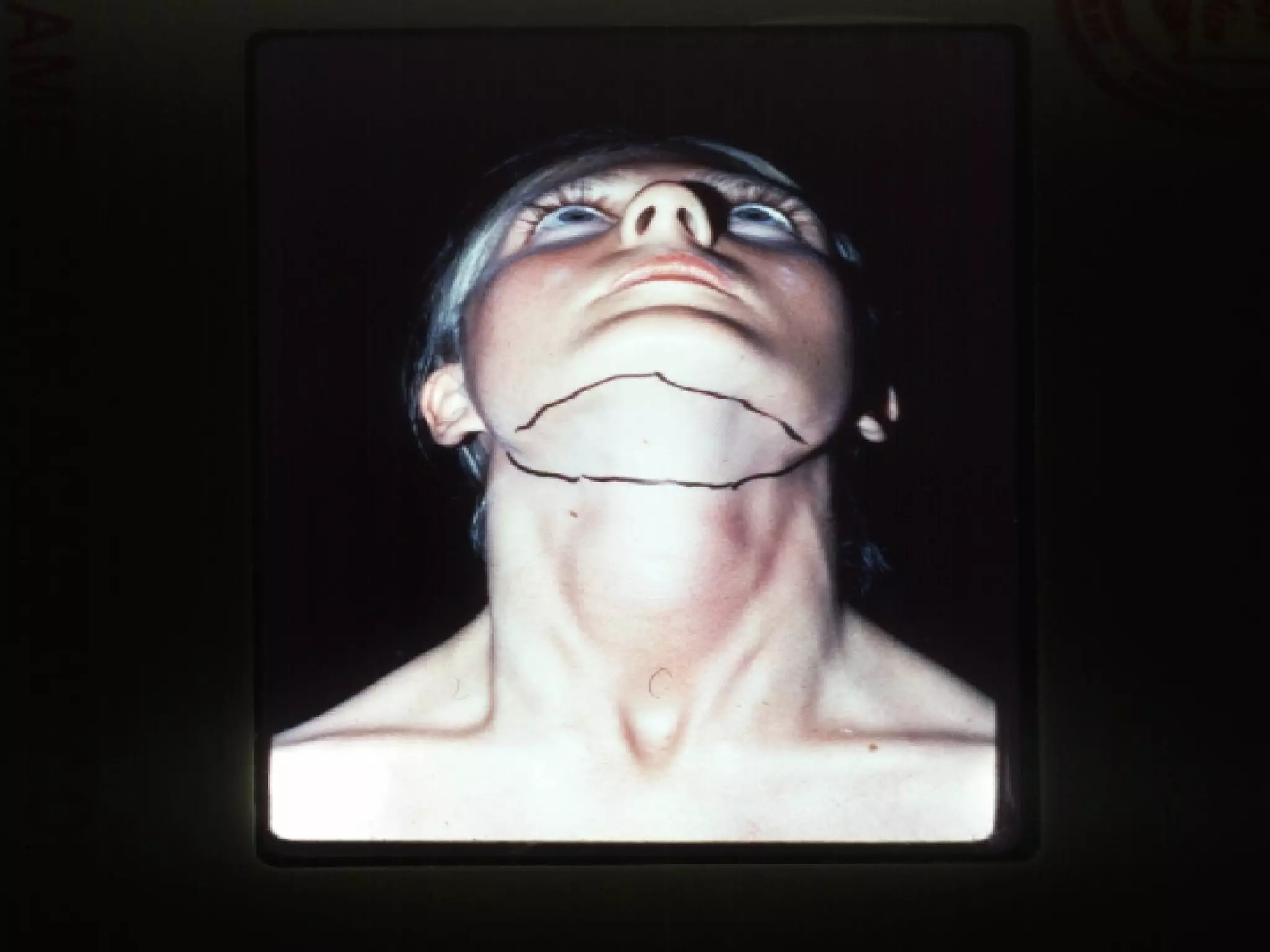 Examination Of The Neck | PPT