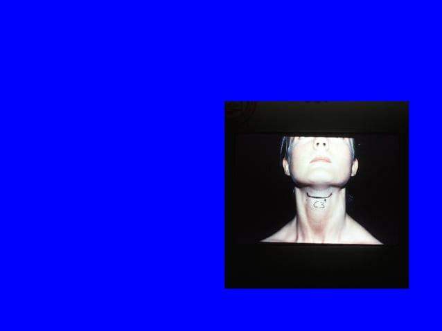 Examination Of The Neck | PPT