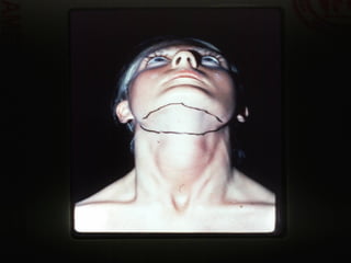 Examination Of The Neck | PPT