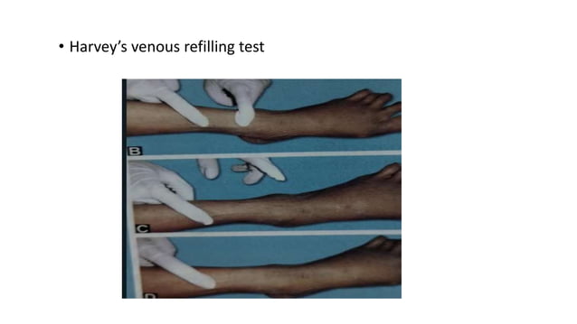 EXAMINATION AND CLINICAL APPROACH IN ARTERIAL DISEASES.pptx