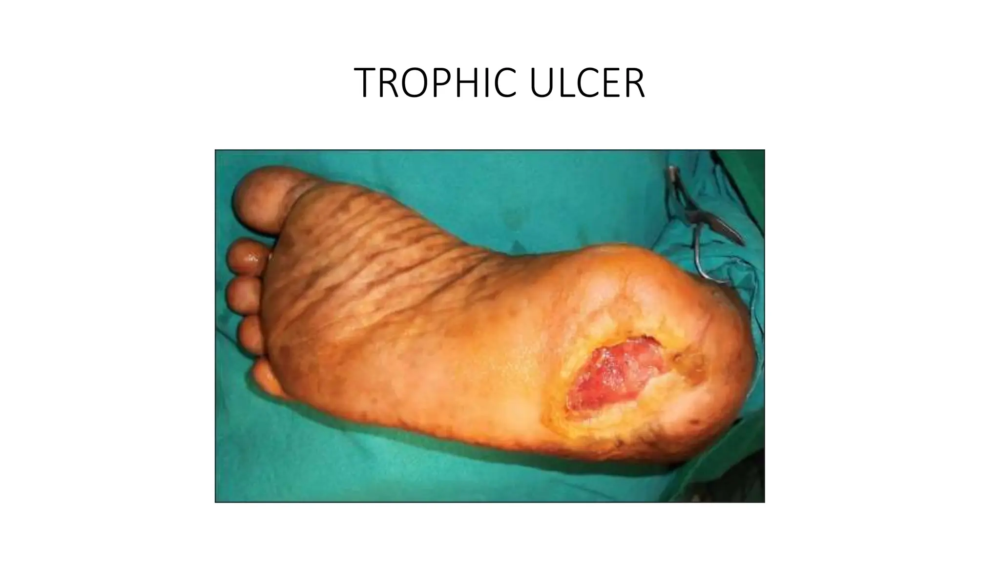 EXAMINATION AND CLINICAL APPROACH OF AN ULCER.pptx