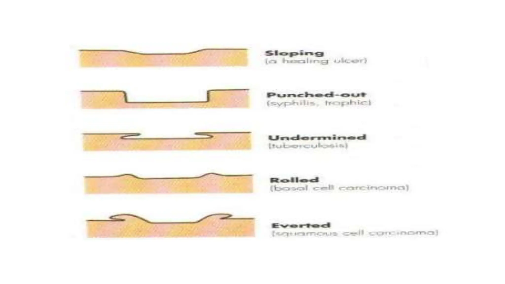 EXAMINATION AND CLINICAL APPROACH OF AN ULCER.pptx