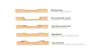 EXAMINATION AND CLINICAL APPROACH OF AN ULCER.pptx
