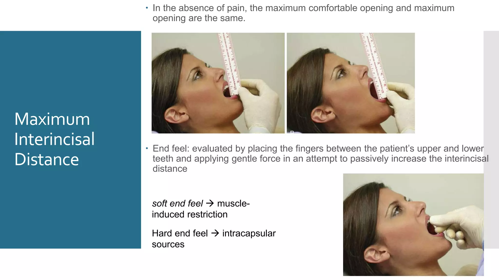 Examination and diagnosis of tmd | PPTX