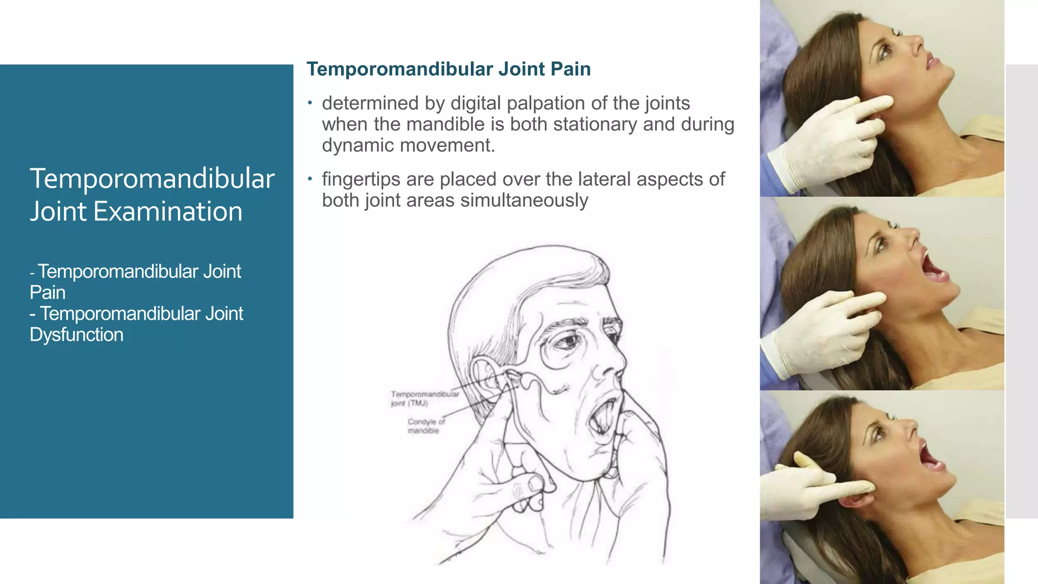 Examination and diagnosis of tmd | PPTX