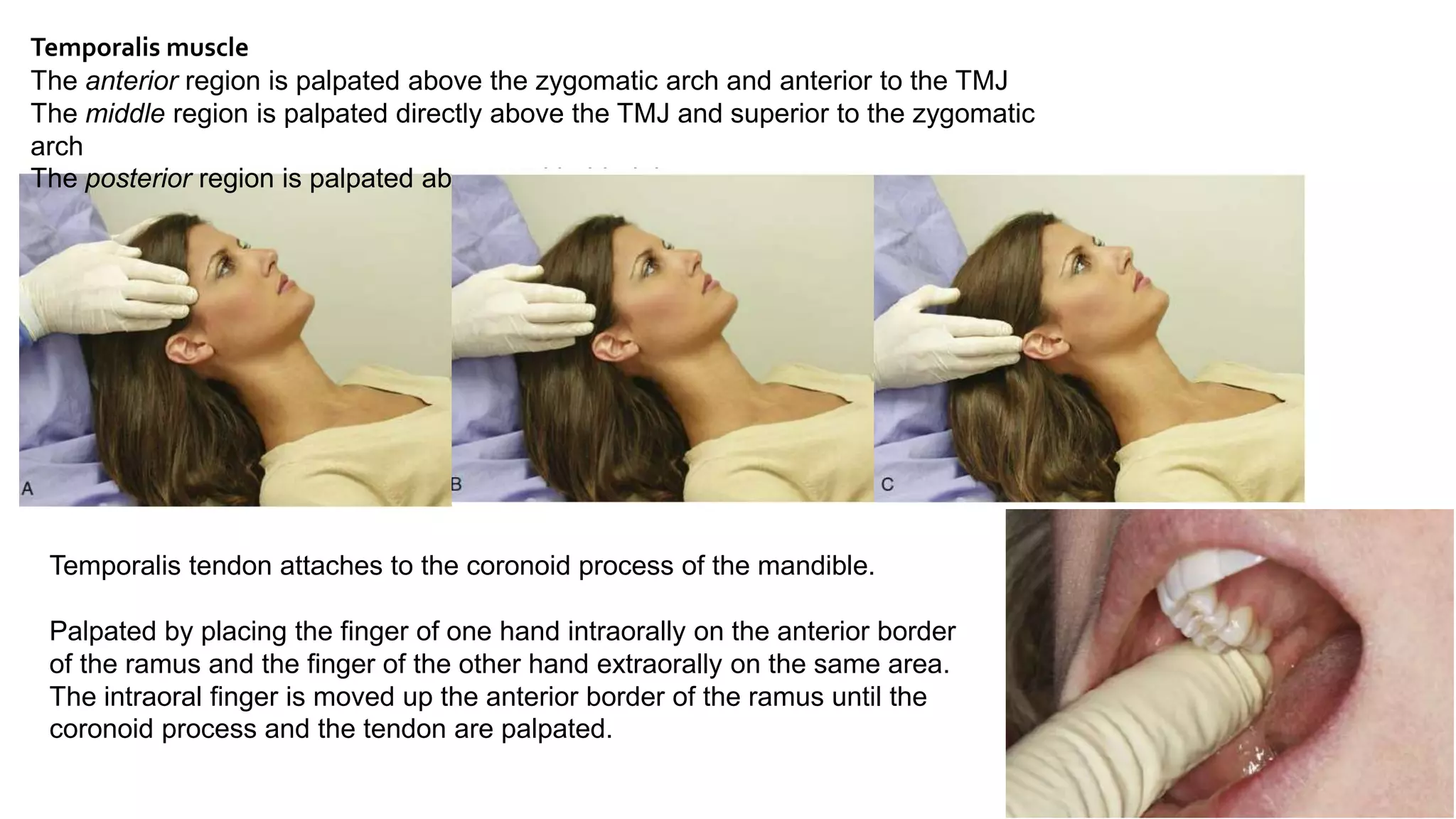 Examination and diagnosis of tmd | PPTX