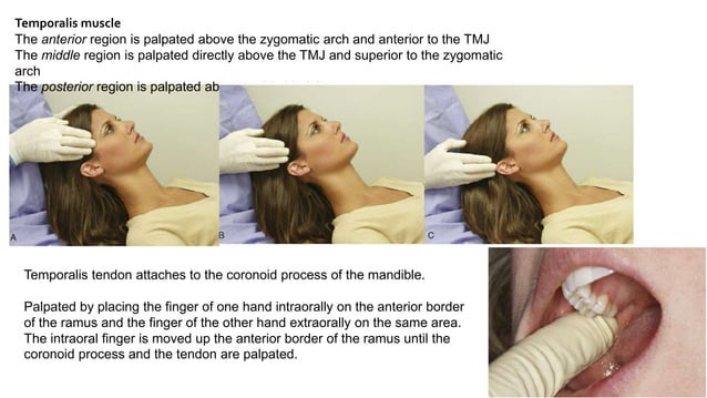 Examination and diagnosis of tmd | PPTX