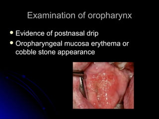 Examination cough | PPT