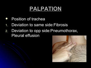 Examination cough | PPT