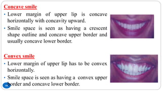 Examination & diagnosis of edentulous patients | PPTX