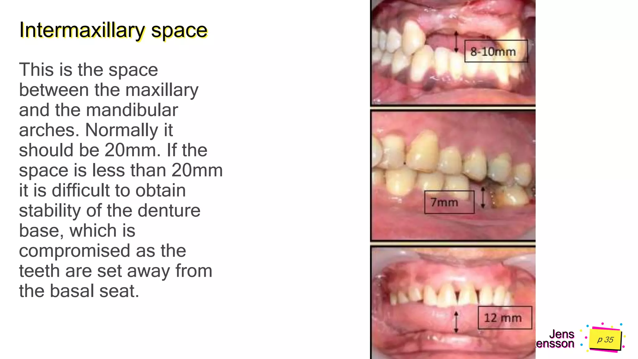 Examination & diagnosis of prosthetic patient | PPTX