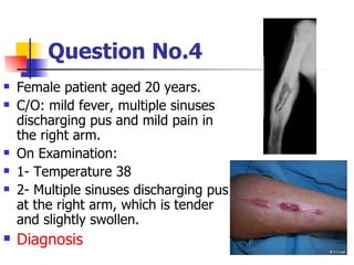 Examination no. 4 | PPT