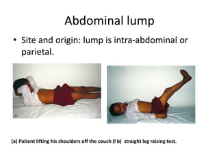 Examination of Abdomen.pptx