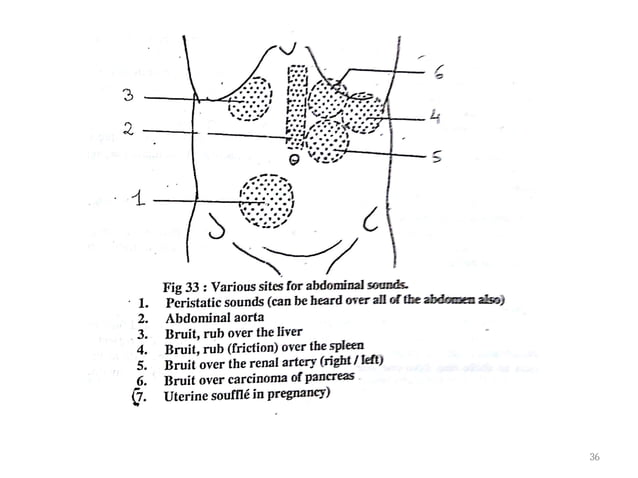 Examination of Abdomen Demo lec JP.pptx