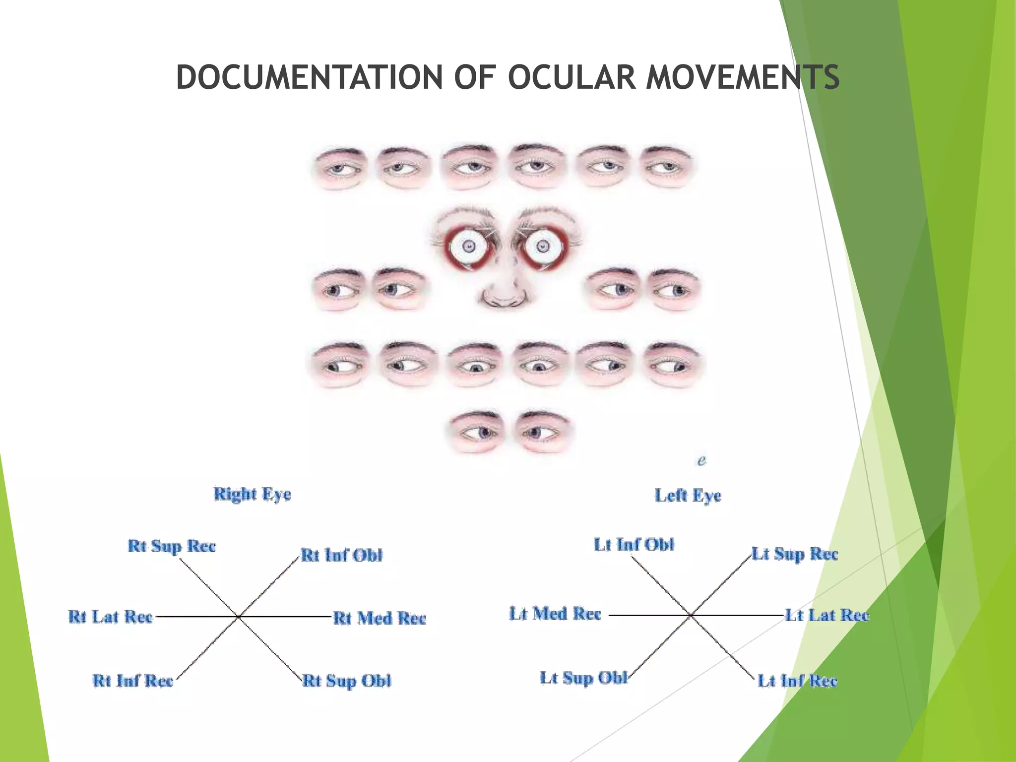 Examination of a case of squint | PPTX