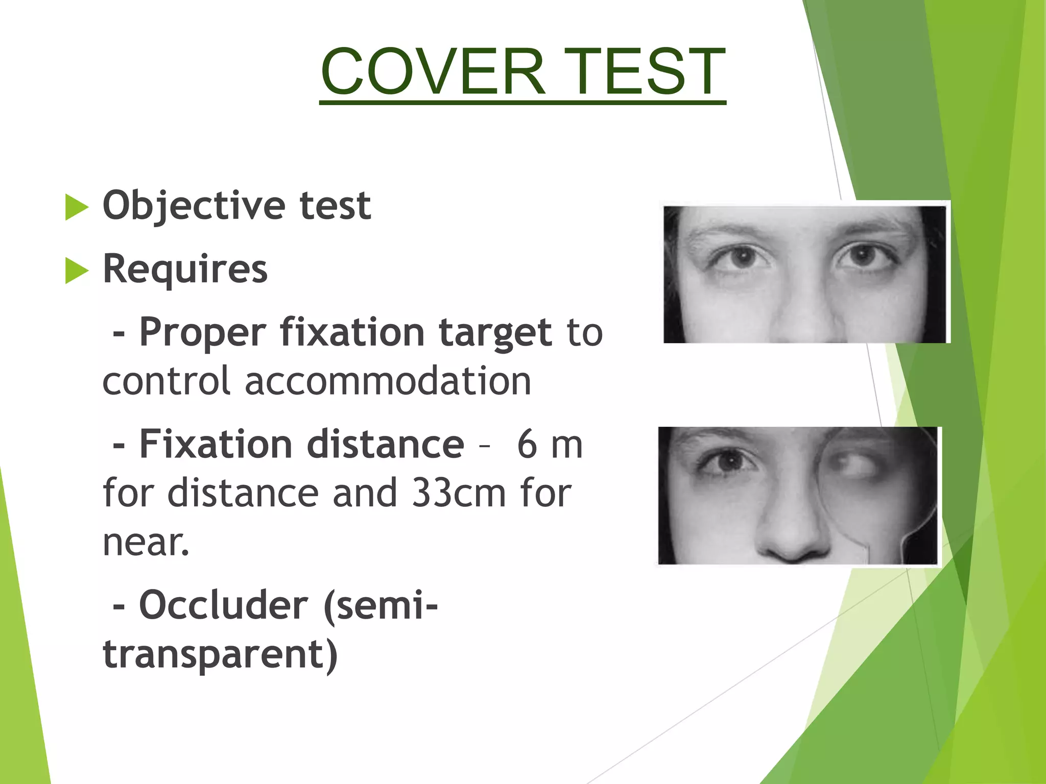 Examination of a case of squint | PPTX