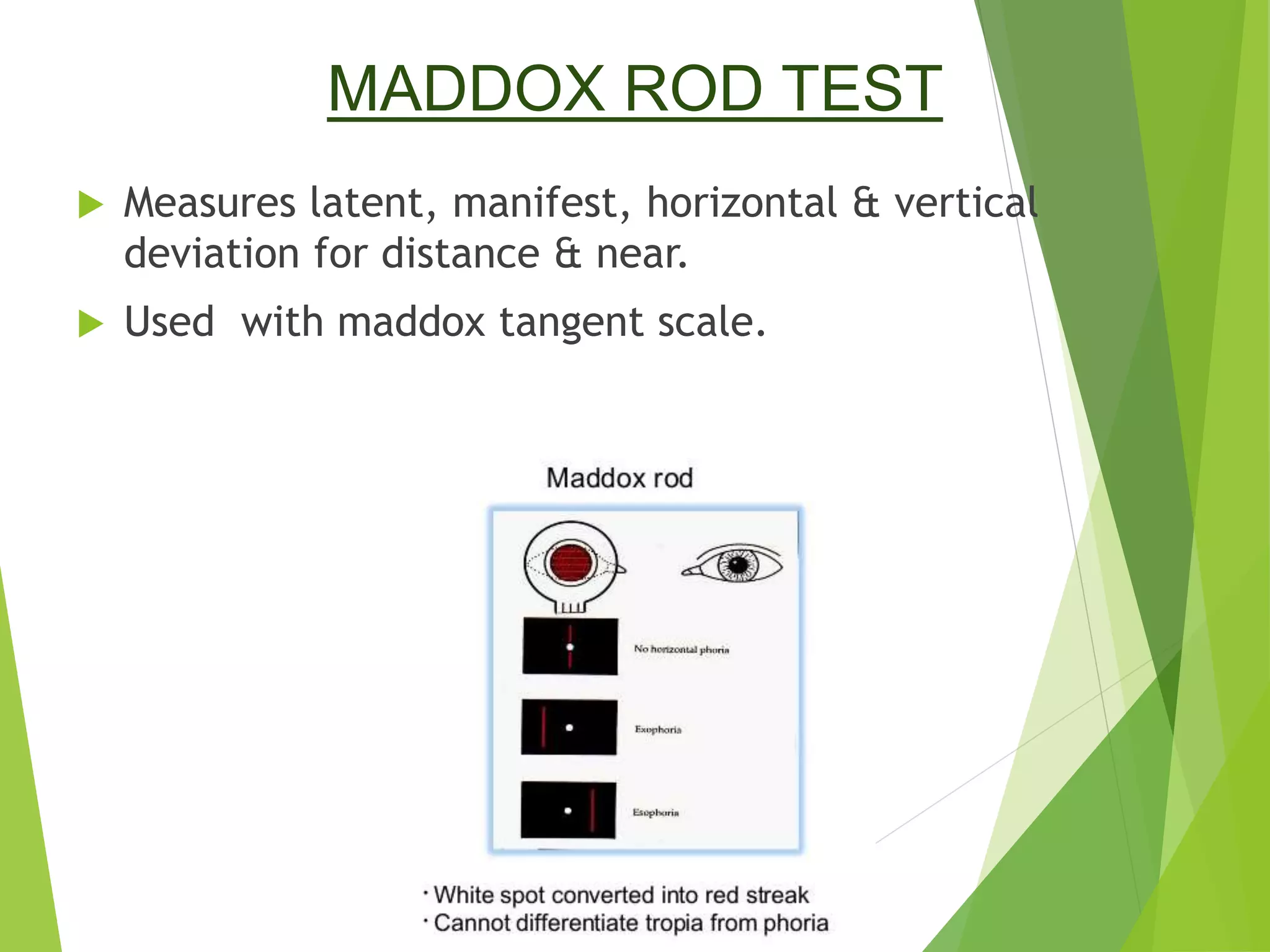 Examination of a case of squint | PPTX