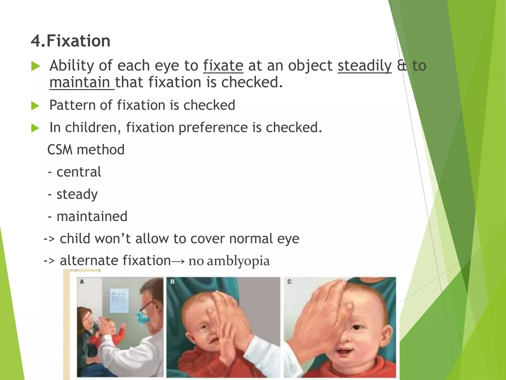 Examination of a case of squint | PPTX