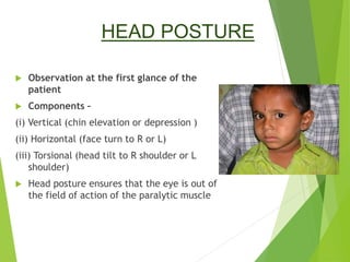 Examination of a case of squint | PPTX | Eye and Vision Conditions ...