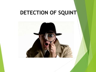 Examination of a case of squint | PPTX