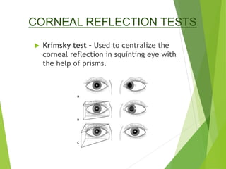 Examination of a case of squint | PPTX