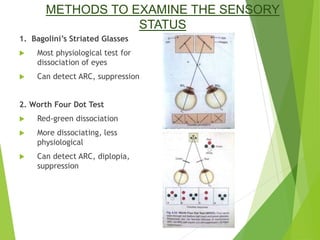 Examination of a case of squint | PPTX