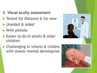 Examination of a case of squint | PPTX