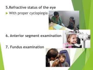 Examination of a case of squint | PPTX