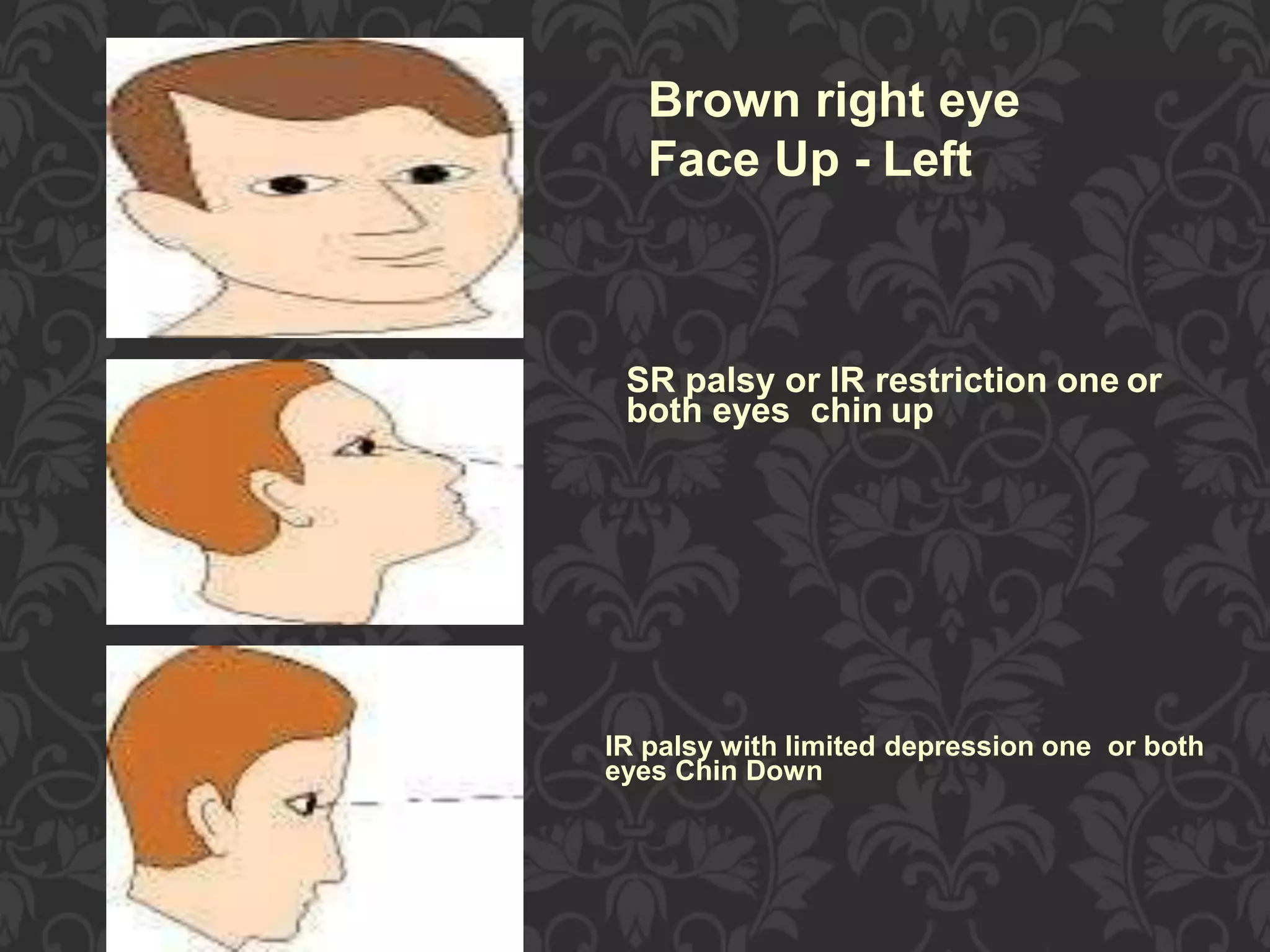 Examination of a case of strabismus | PPTX