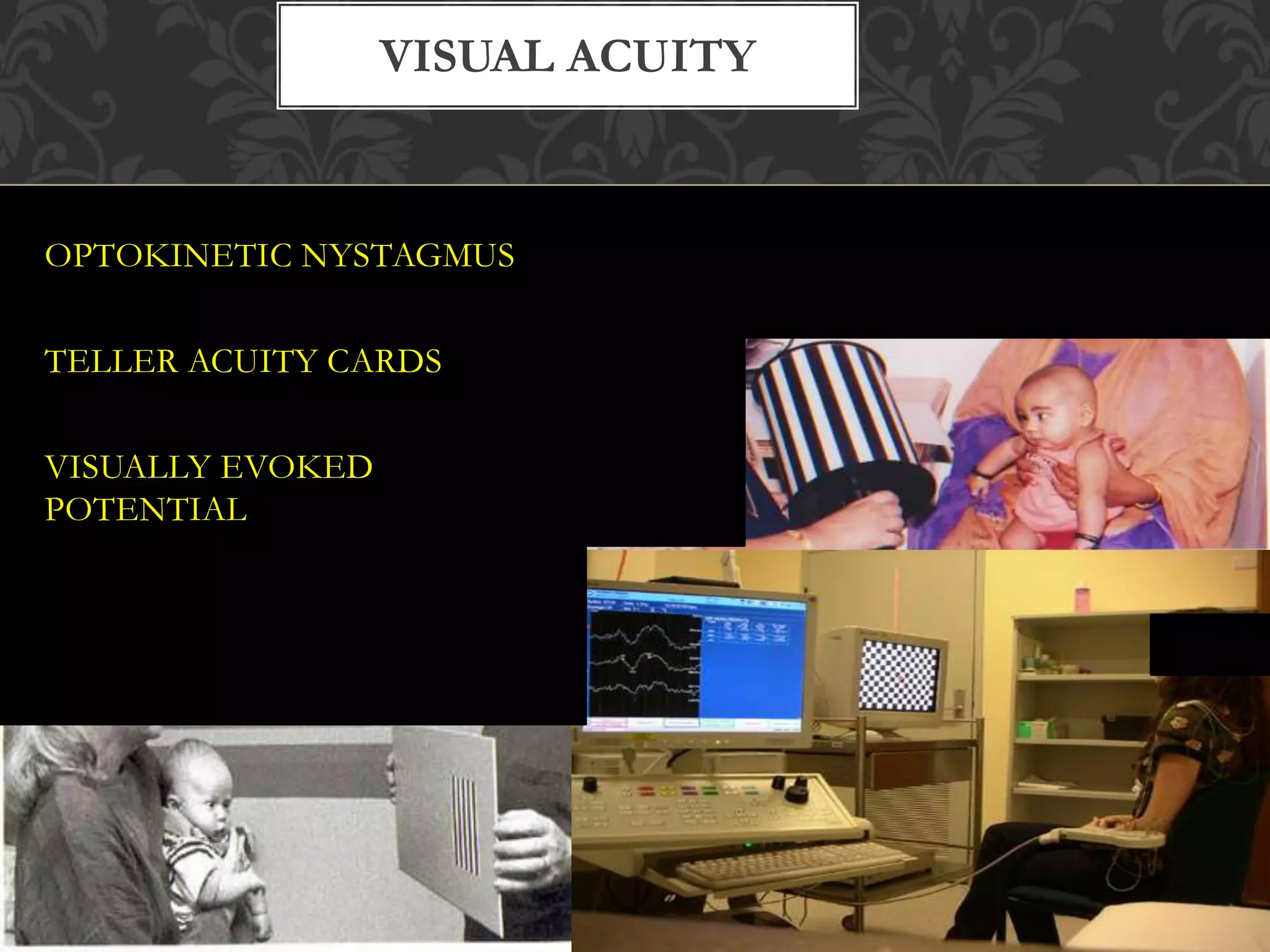 Examination of a case of strabismus | PPTX