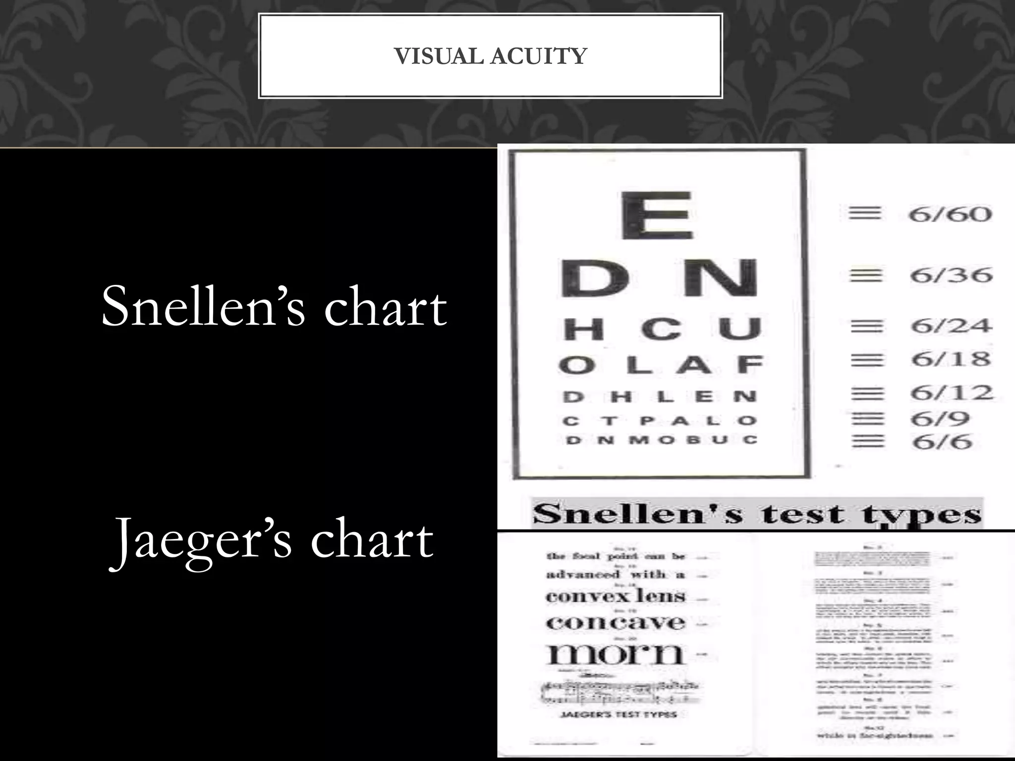 Examination of a case of strabismus | PPTX