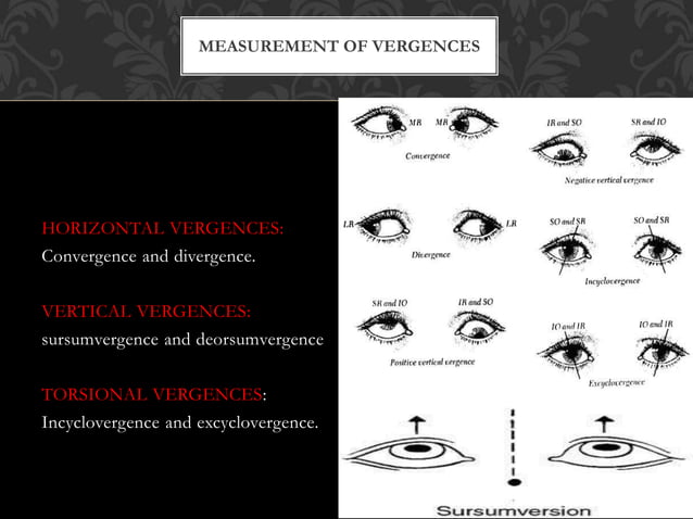 Examination of a case of strabismus | PPTX | Eye and Vision Conditions ...