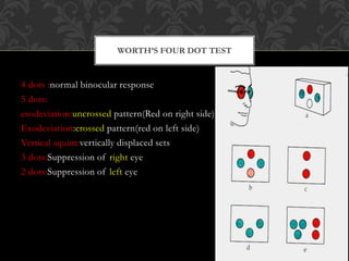 Examination of a case of strabismus | PPTX