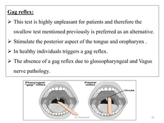 Gag Reflex Test