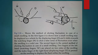 EXAMINATION OF A LUMP OR A SWELLING.pptx | Cancer | Diseases and Conditions