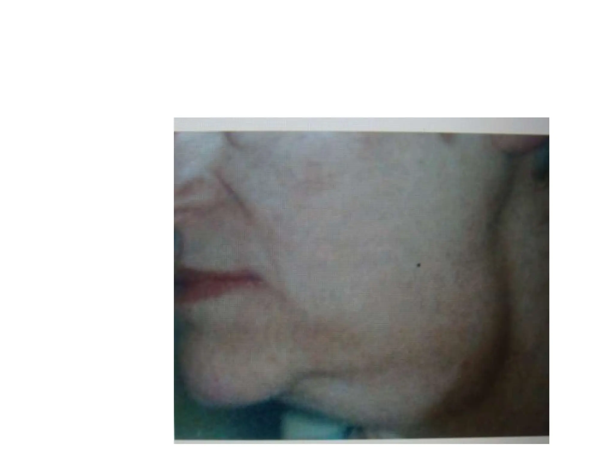 Examination of a lump or a swelling 3.pptx