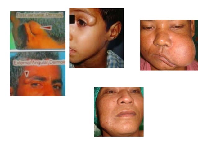 Examination of a lump or a swelling 3.pptx