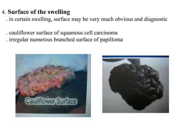 Examination of a lump or a swelling 3.pptx