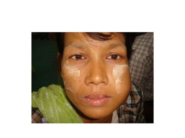 Examination of a lump or a swelling 3.pptx