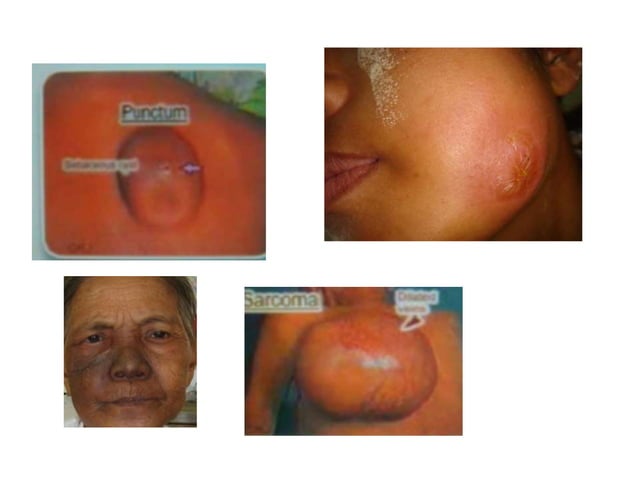 Examination Of A Lump Or A Swelling 3pptx