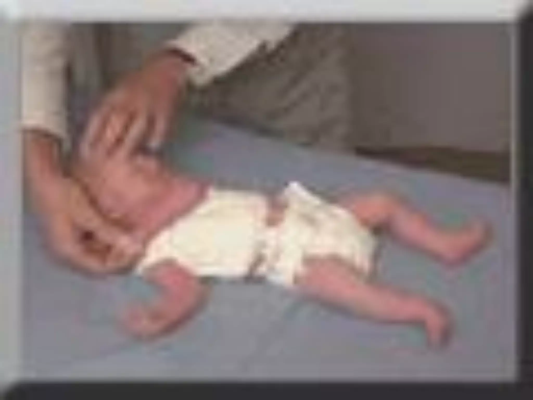 Neurological Examination of an infant | PDF