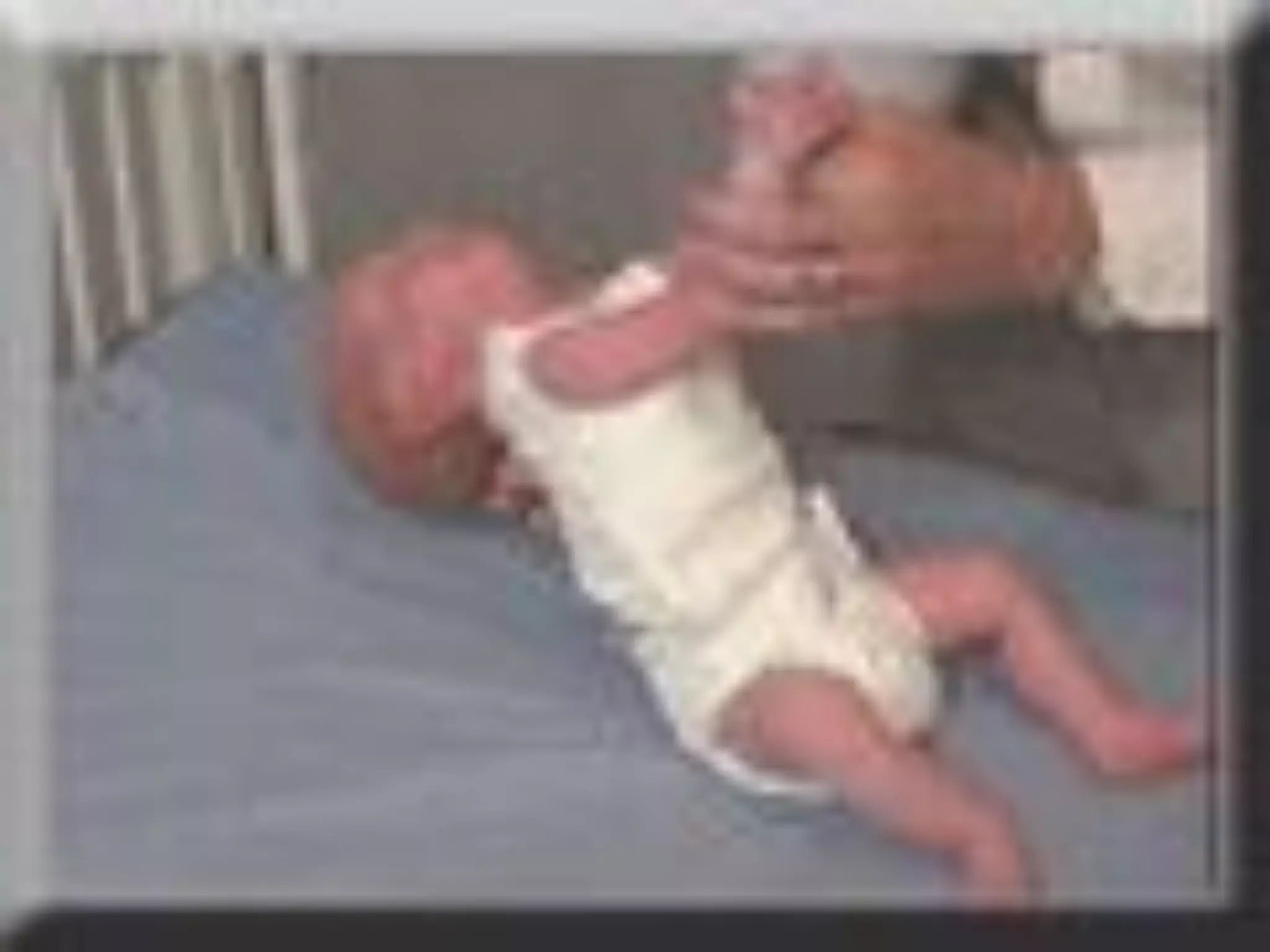 Neurological Examination of an infant | PDF