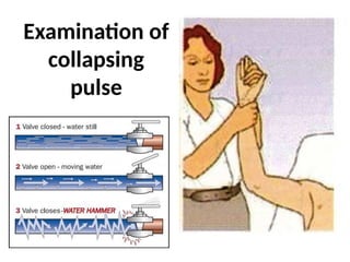 Examination of arterial and venous pulse Mbbs physiology.pptx