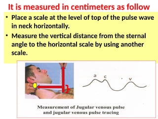 Examination of arterial and venous pulse Mbbs physiology.pptx