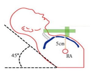 Examination of arterial and venous pulse Mbbs physiology.pptx